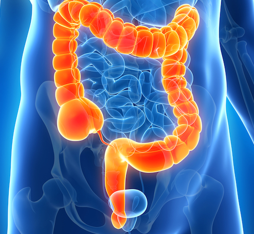 Colon Hydrotherapy - The Therapy that Even Doctors are Recommending ...