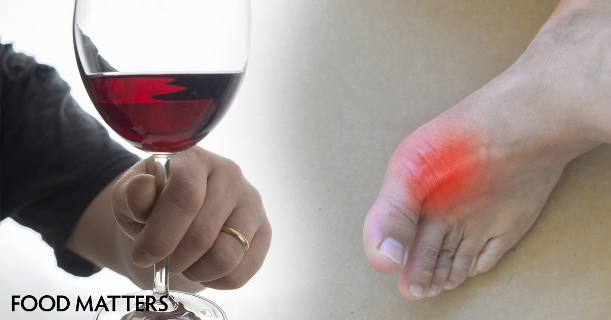 Gout Giving You Trouble? Here's What NOT To Eat! | FOOD MATTERS® Gout Giving You Trouble? Here's What NOT To Eat! | FOOD MATTERS®