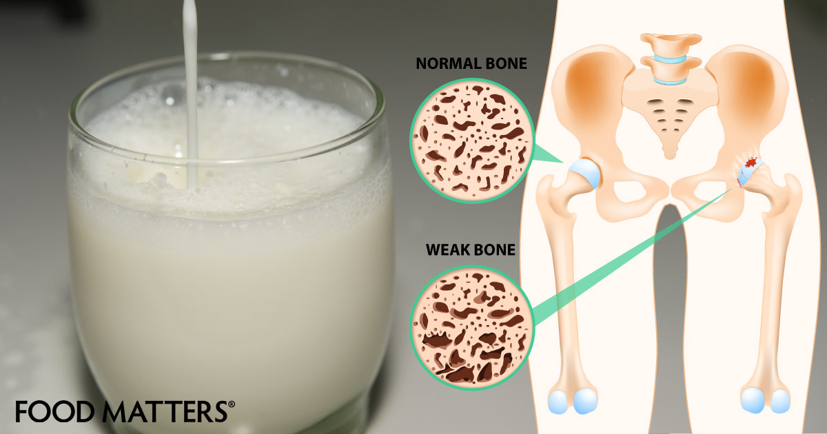 What The Dairy Industry Is Not Telling you... | FOOD MATTERS®
