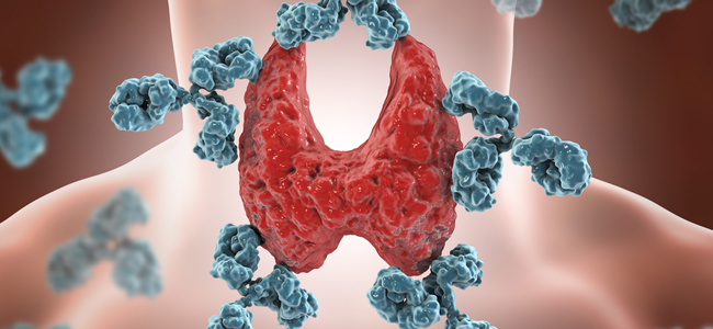 Hashimoto's Disease Articles | FOOD MATTERS®